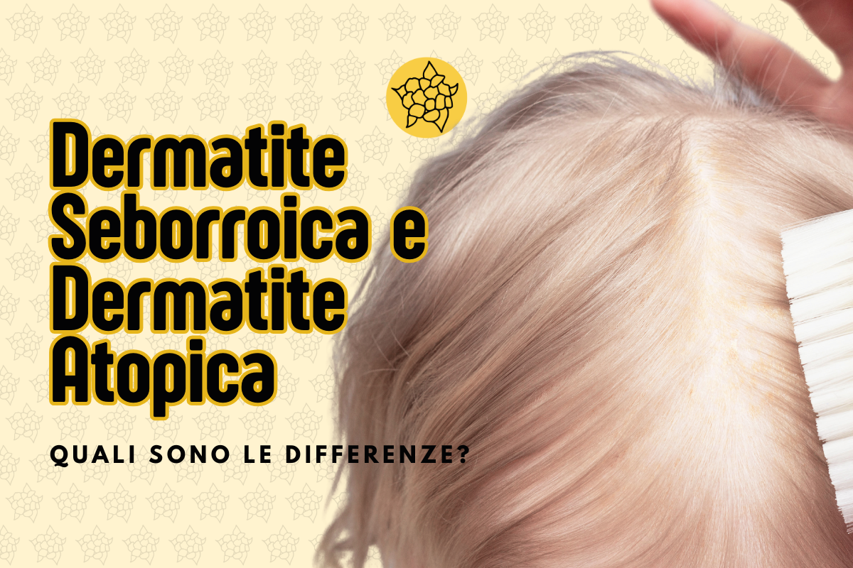Dermatite Atopica e Dermatite Seborroica, le differenze – Metodo Pelle Sana