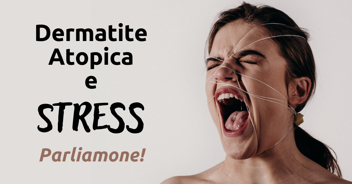 Dermatite Atopica: come lo stress danneggia la pelle – Metodo Pelle Sana